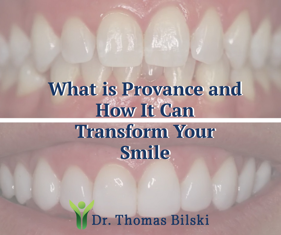 What is Provance and How It Can Transform Your Smile