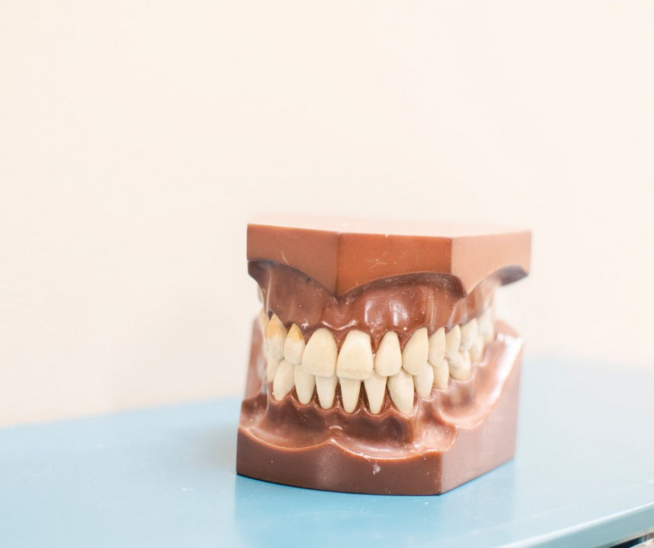 Common Misconceptions About Root Canals