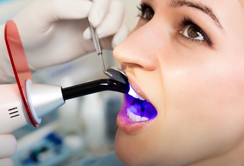 What Is A Tooth Filling?